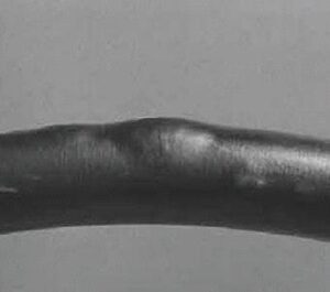 5 Common Problems in Compression Molding Process - Topgrid